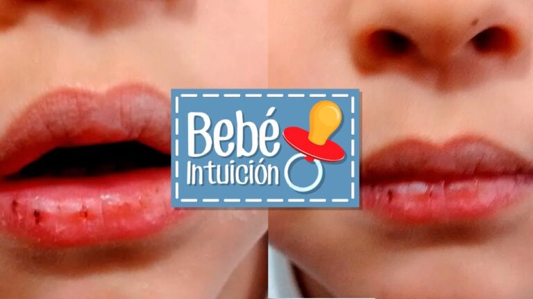 ¿Por qué mi bebé tiene los labios secos? Descubre las causas y ...