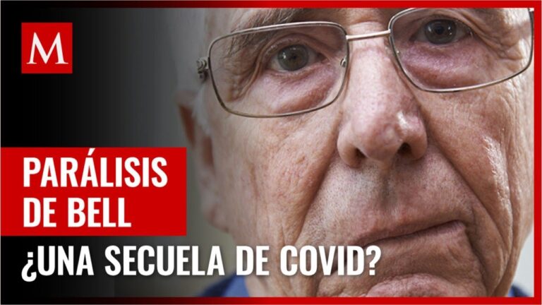 Todo lo que necesitas saber sobre la parálisis de Bell: causas ...
